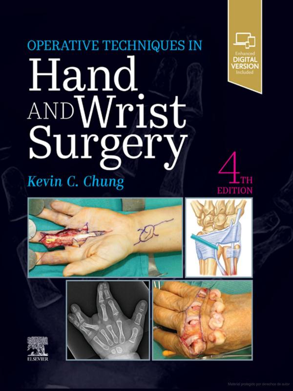 Kevin C. Chung – Operative Techniques. Hand and Wrist Surgery (2023 ...